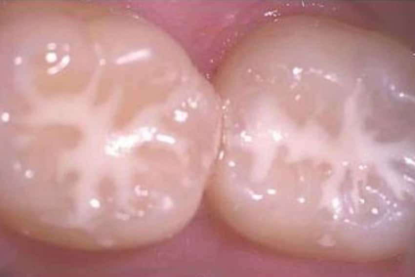 Services - Tepe Dentistry - Colleen Tepe Hofstetter, DDS